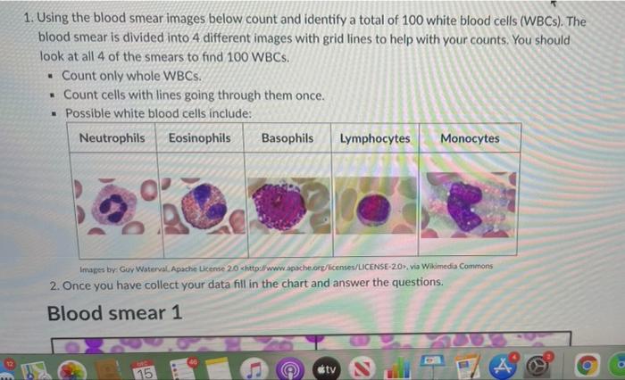 Solved 1. Using the blood smear images below count and | Chegg.com