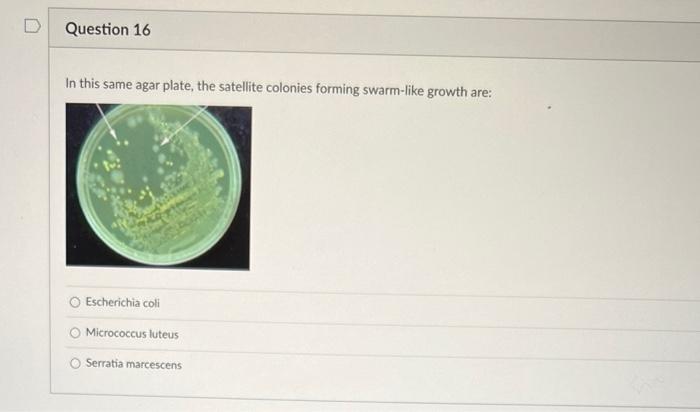 Solved In this same agar plate, the satellite colonies | Chegg.com