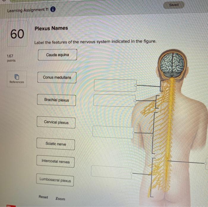 Solved Saved Learning Assignment 11 Plexus Names 60 Label | Chegg.com