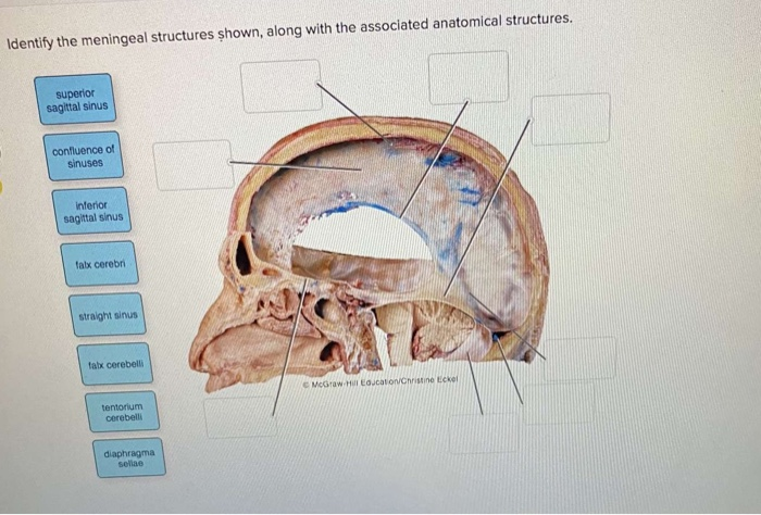 Solved Identify the meningeal structures shown, along with | Chegg.com Solved Identify the meningeal structures shown, along with | Chegg.com