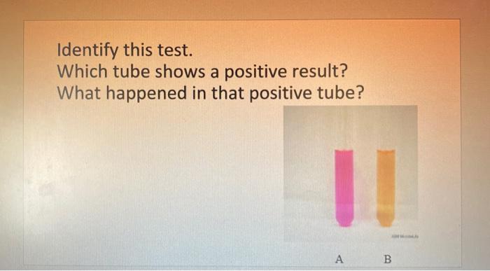 Solved Identify this test. Which tube shows a positive | Chegg.com