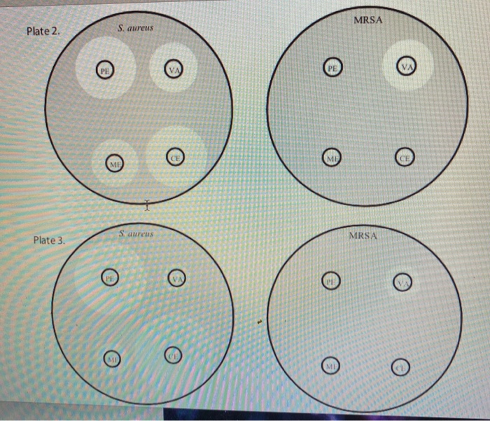 Solved S. aureus MRSA Plate 1. MRSA Plate 2 S. aureus PE | Chegg.com
