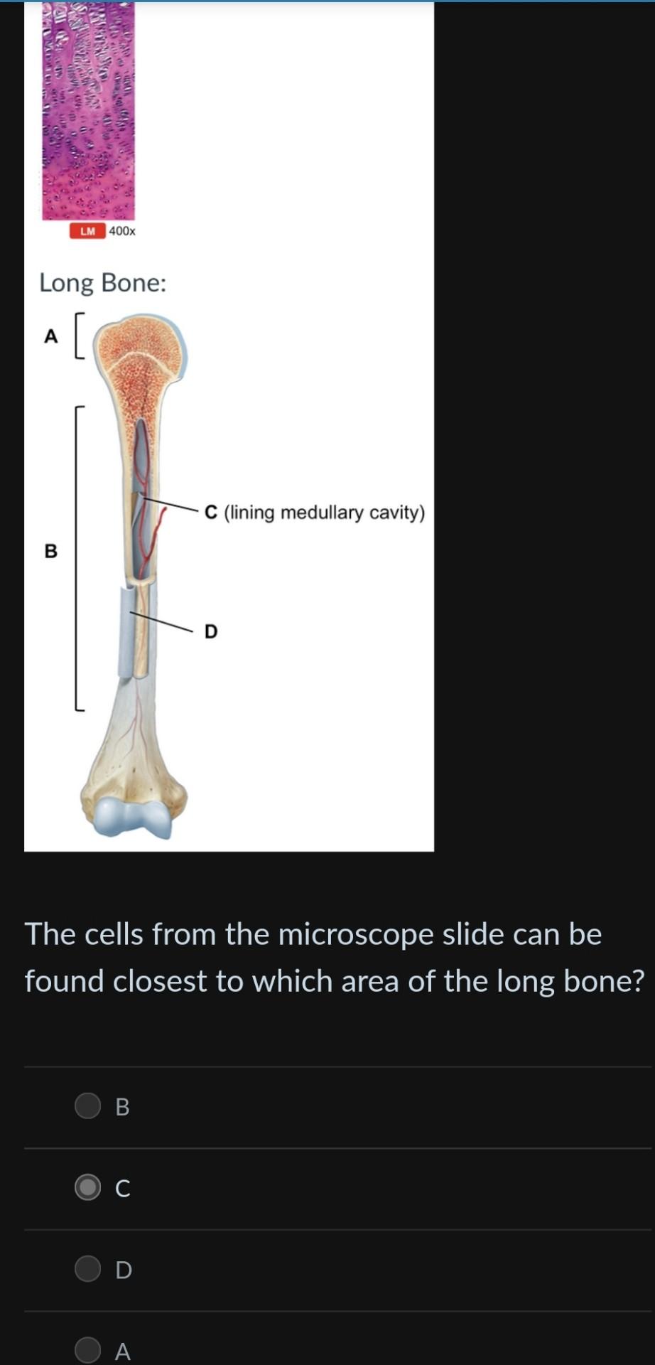Solved Microscope Slide: Long Bone: I nno Rnno. The cells | Chegg.com