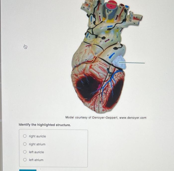 Solved Model courtesy of Denoyer-Geppert, www.denoyer.com | Chegg.com