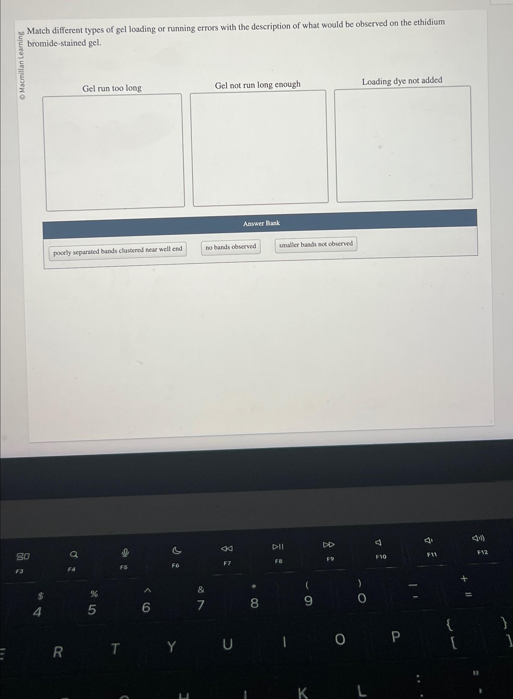 Solved Match different types of gel loading or running | Chegg.com