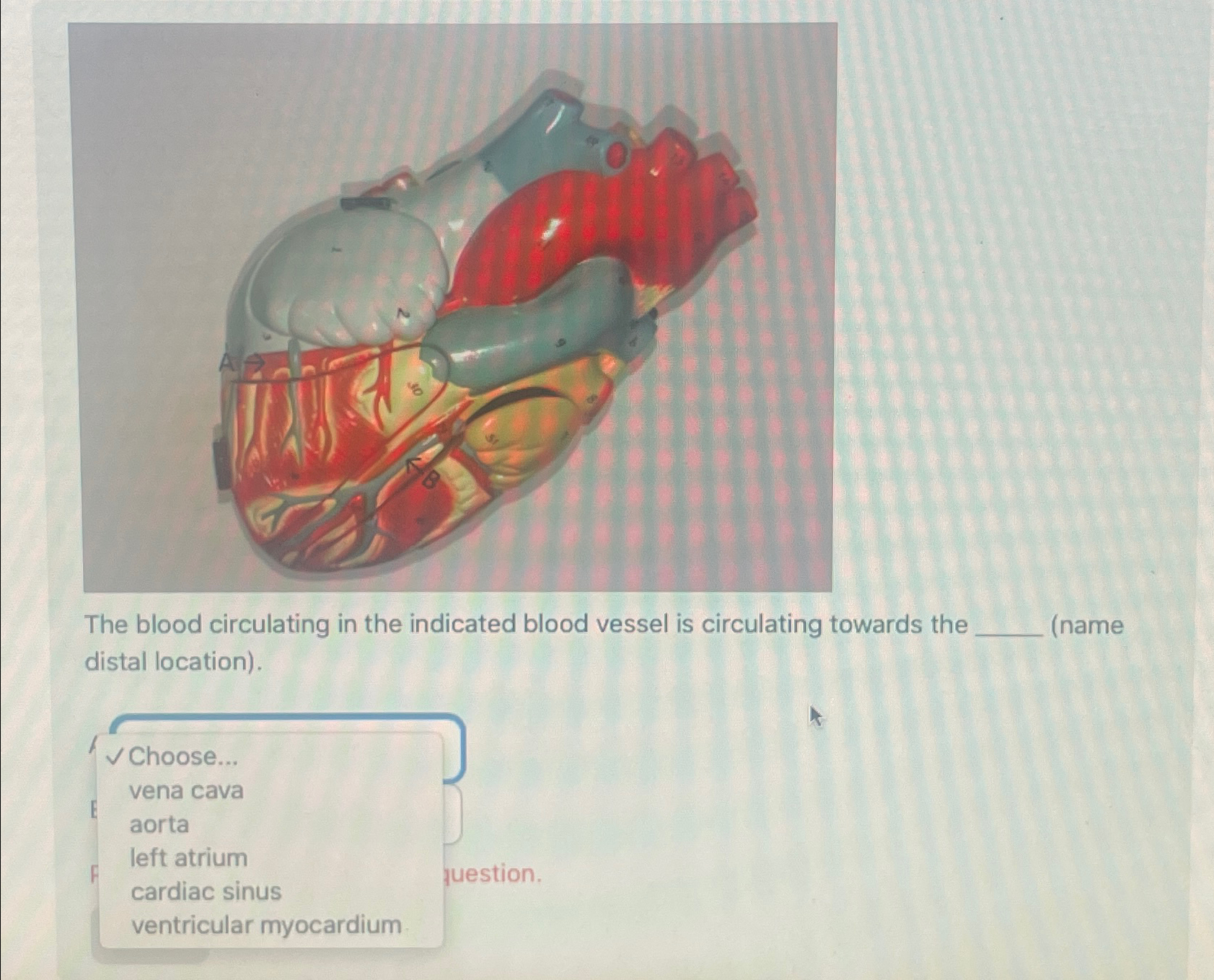 Solved The blood circulating in the indicated blood vessel | Chegg.com