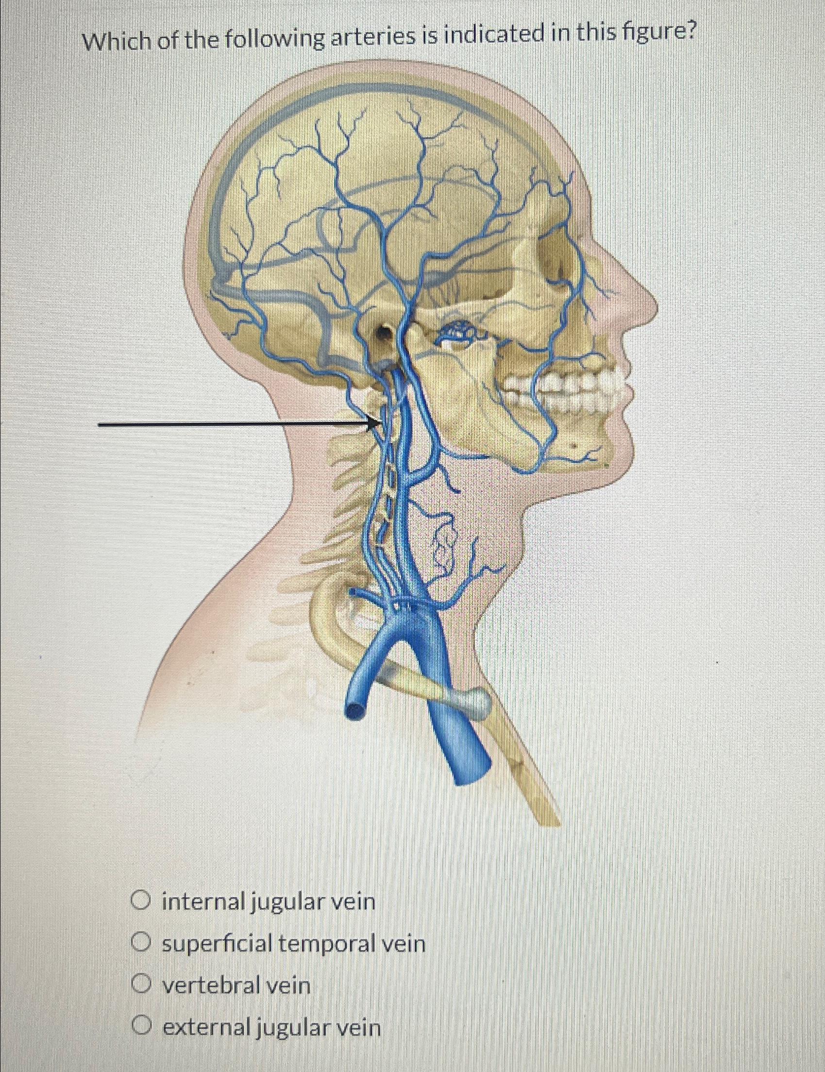 Solved Which of the following arteries is indicated in this | Chegg.com