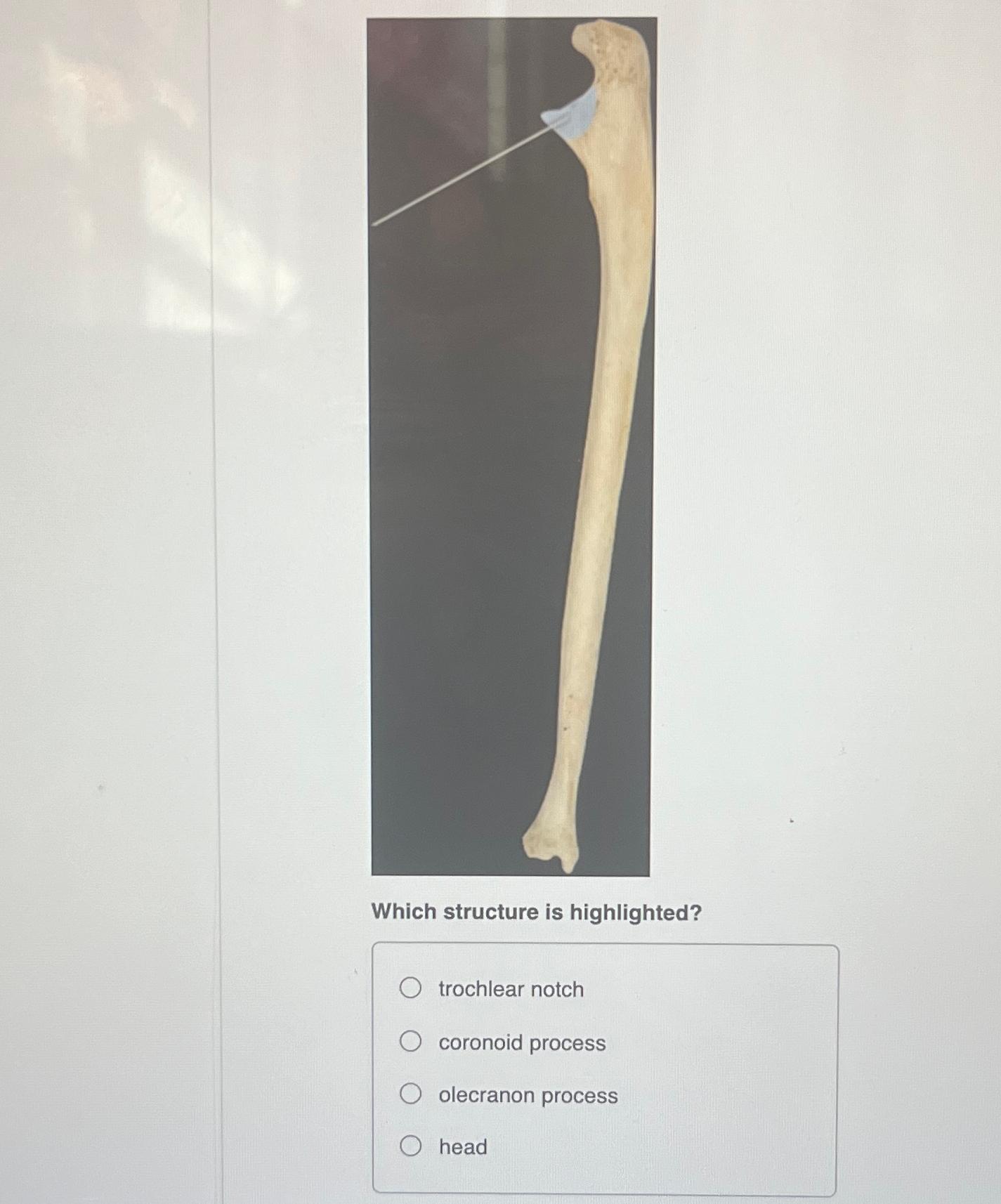 Solved Which structure is highlighted?trochlear | Chegg.com