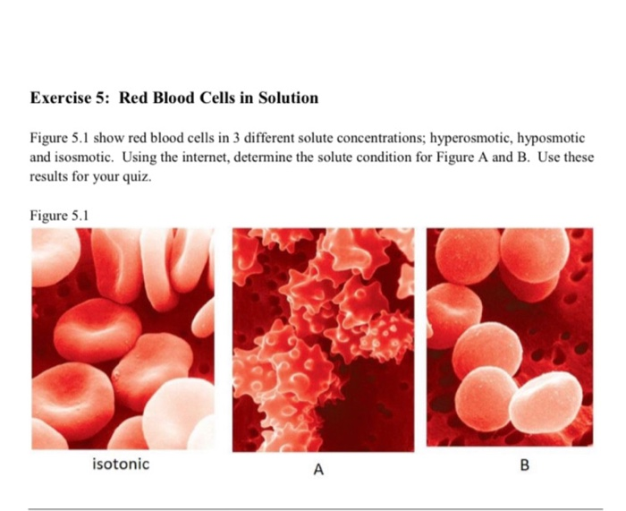 Solved Exercise 5: Red Blood Cells in Solution Figure 5.1 | Chegg.com