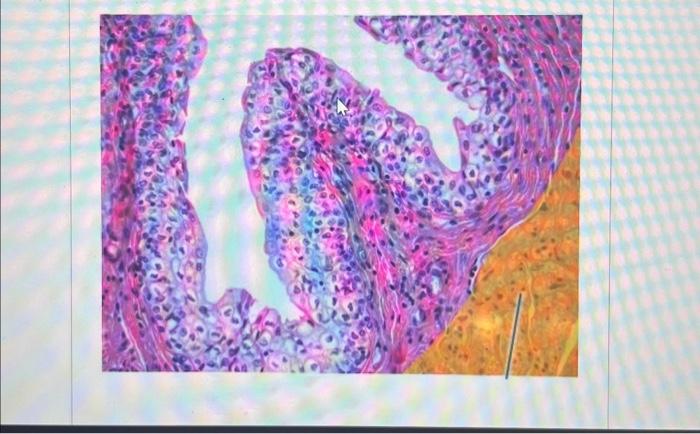 Solved Which structure is highlighted? lamina propria | Chegg.com