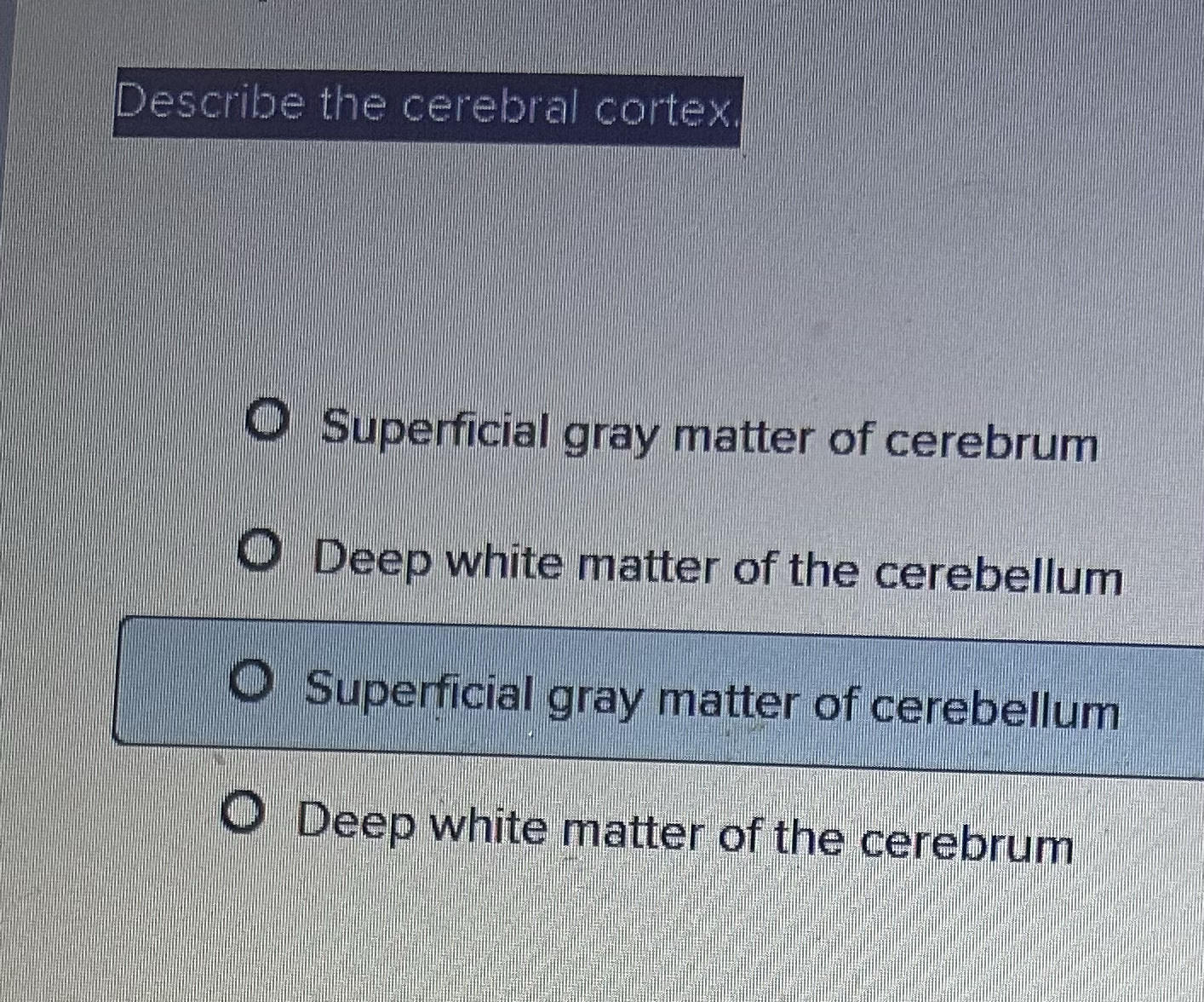Solved Describe the cerebral cortex.Superficial gray matter | Chegg.com