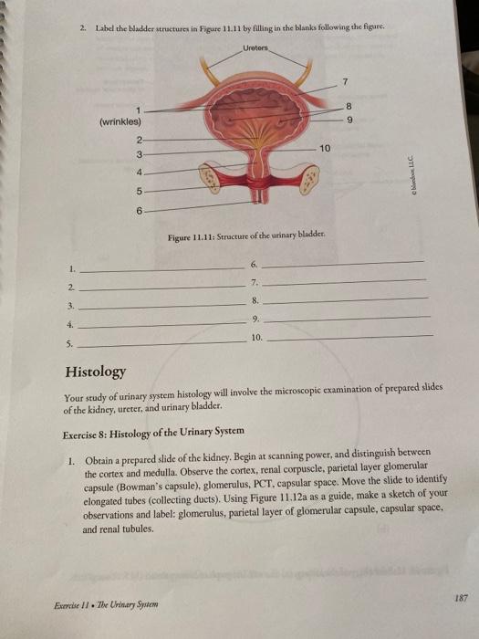 Solved 2. Label the bladder structures in Figure 11.11 by | Chegg.com