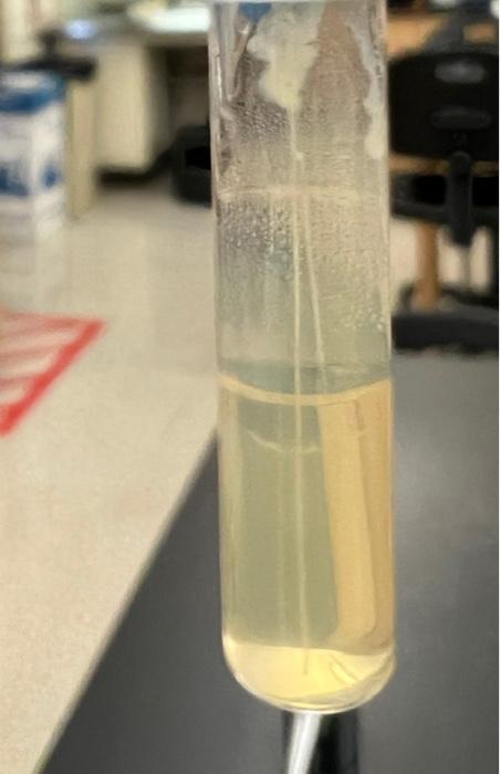 Does S. Saprophyticus ferment or grow in MSA? If so, | Chegg.com