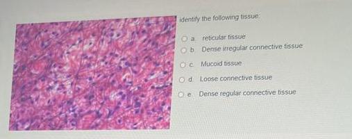 Solved idenity the following tissuea. ﻿reticular fissueb. | Chegg.com