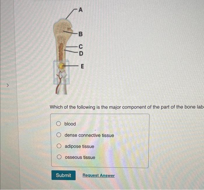 Solved Which of the following is the major component of the | Chegg.com