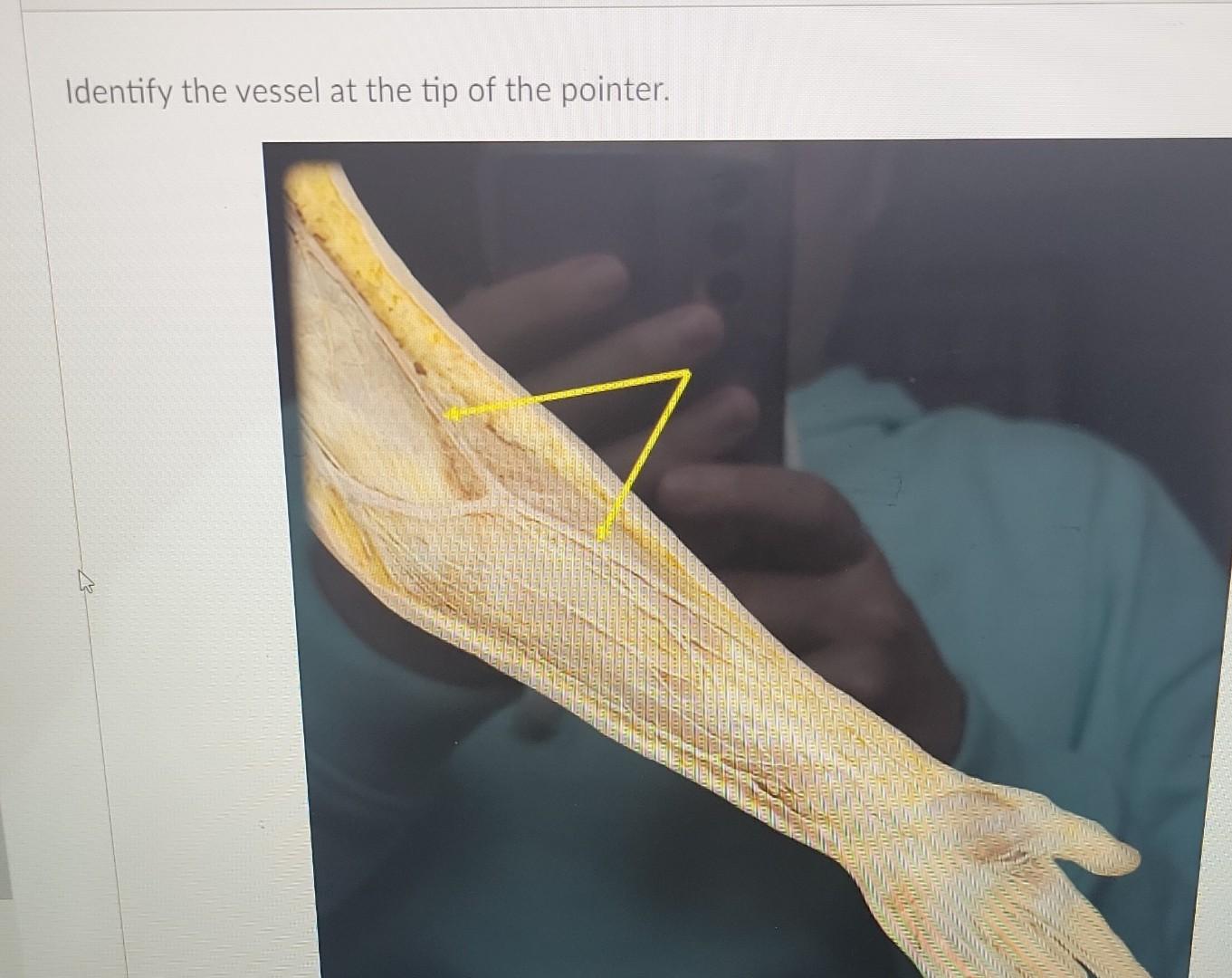 Solved y the vessel at the tip of the pointer.Identify the | Chegg.com