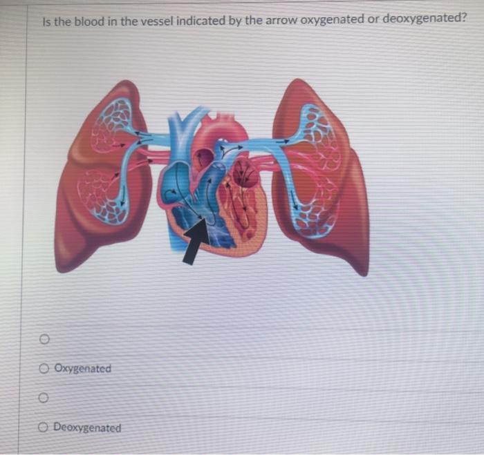 Solved Is the blood in the vessel indicated by the arrow | Chegg.com