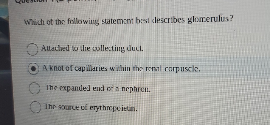 Solved Which of the following statement best describes | Chegg.com