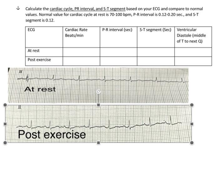 Solved Calculate the cardiac cycle, PR interval, and S-T | Chegg.com