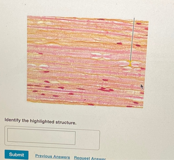 Solved Identify the highlighted structure. Submit Previous | Chegg.com