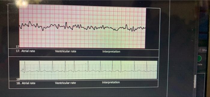 Solved use the pictures below to identify the rhythms and | Chegg.com
