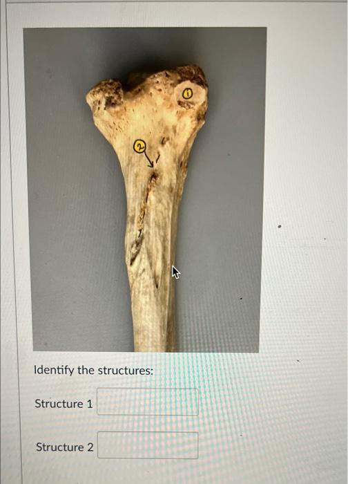 Solved Identify the structures: Structure 1 Structure 2 | Chegg.com