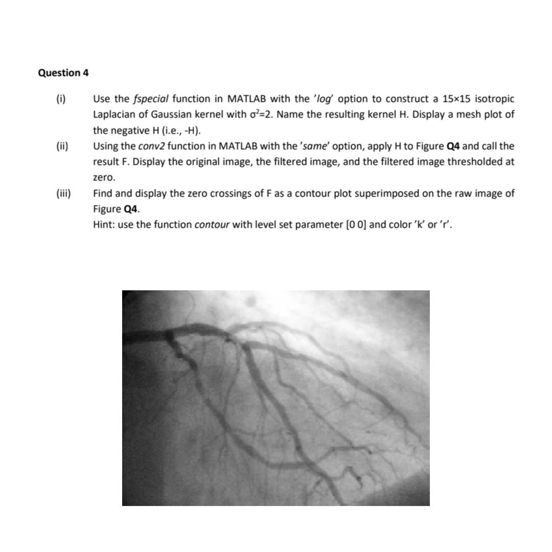 Solved Question 4 (i) Use the fspecial function in MATLAB | Chegg.com