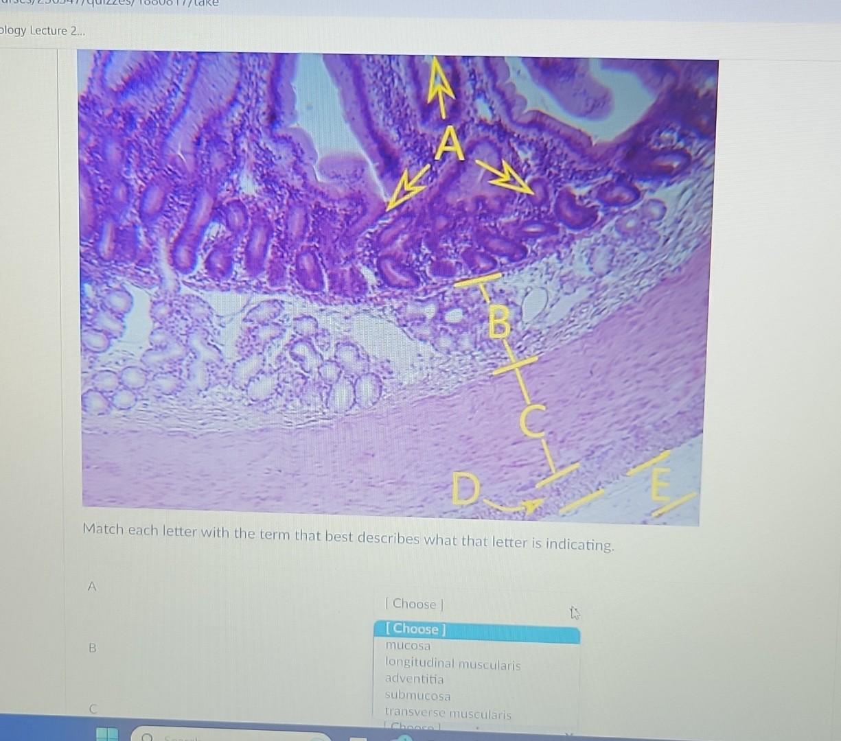 name the labeled parts. the options are mucosa, | Chegg.com