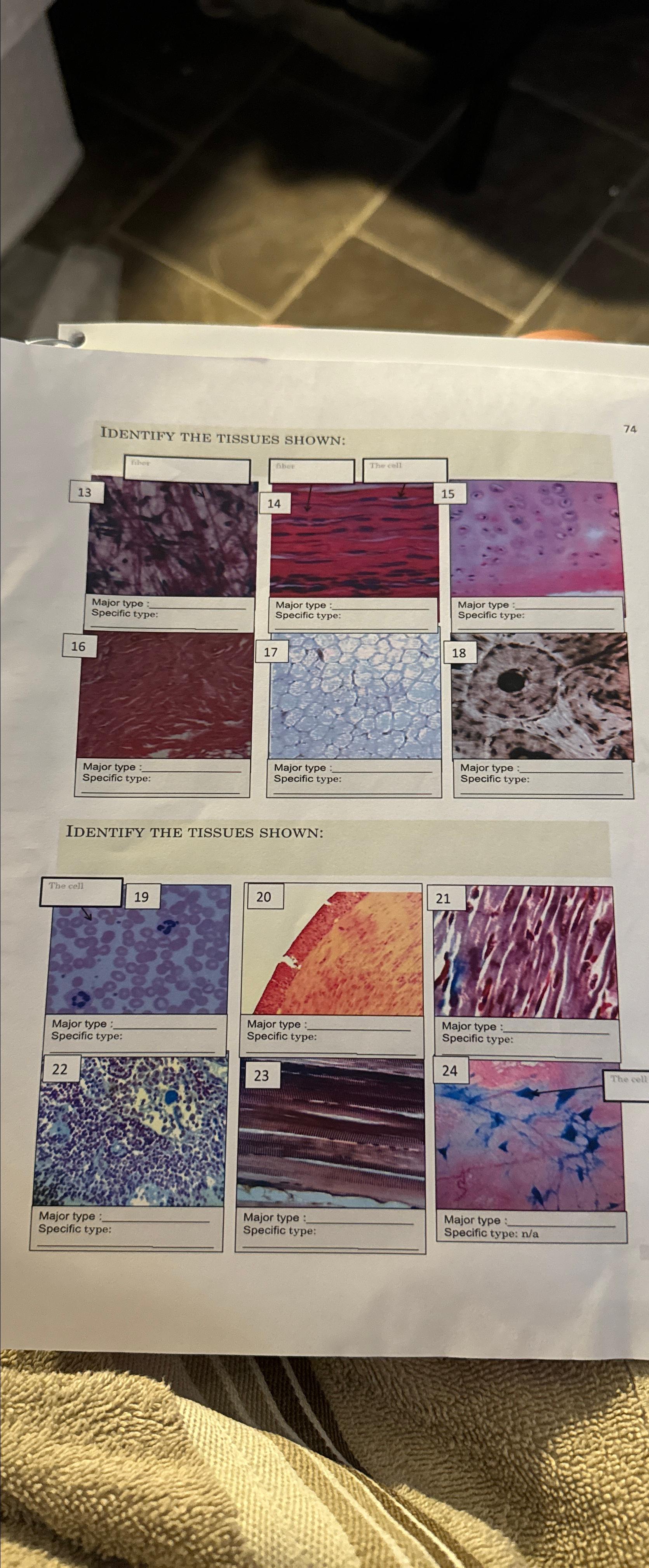 Solved IDENTIFY THE TISSUES SHOWN:74 | Chegg.com