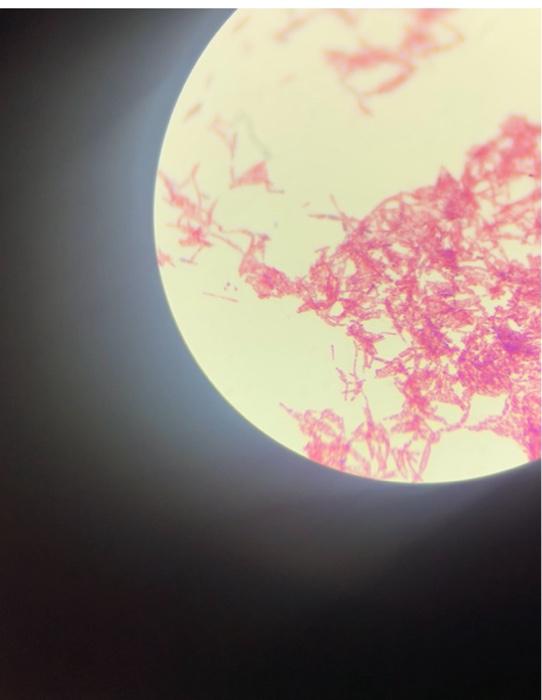 Solved any ideas on what my unknown bacteria looks like ? im | Chegg.com