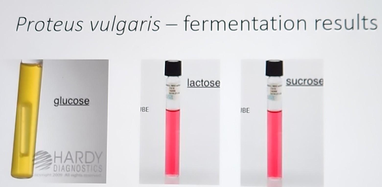 MRVP results - E. coli \& E. aerogenes IVIK | Chegg.com