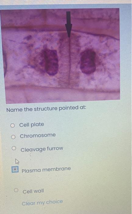 Solved Name the structure pointed at: O Cell plate O | Chegg.com