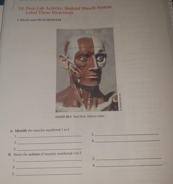 Solved VI. Post-Lab Activity: Skeletal Muscle System Label | Chegg.com