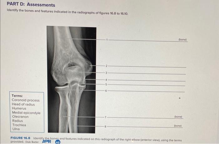 Solved PART D: Assessments Identify the bones and features | Chegg.com