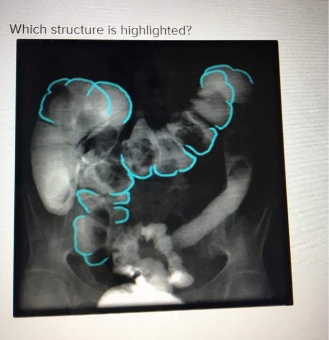 Solved Which structure is highlighted? Multiple Choice O | Chegg.com