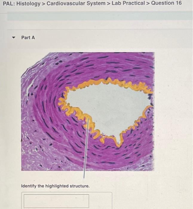 Solved PAL: Histology > Cardiovascular System > Lab | Chegg.com