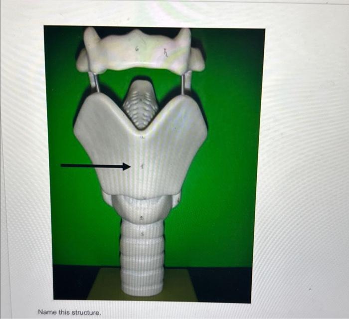 Solved Name this structure.Name this structure. a. arytenoid | Chegg.com