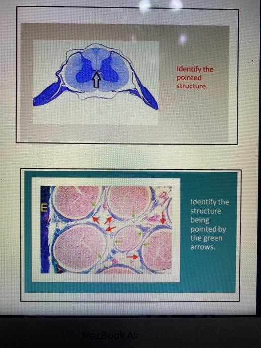 Solved Identify the pointed structure. E Identify the | Chegg.com