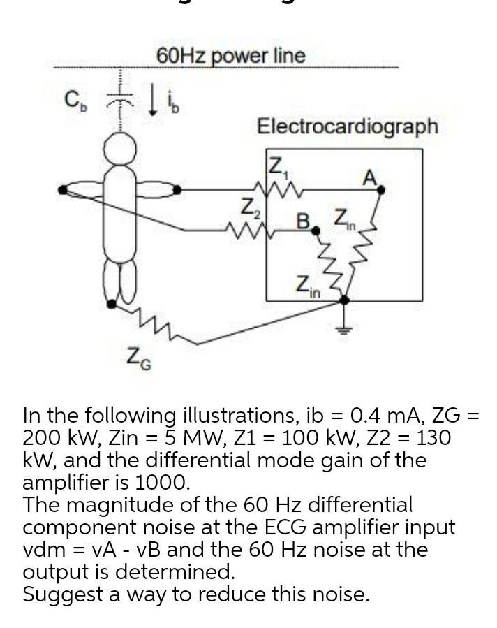 C. 60Hz power line lib Electrocardiograph Z A Z חר | Chegg.com