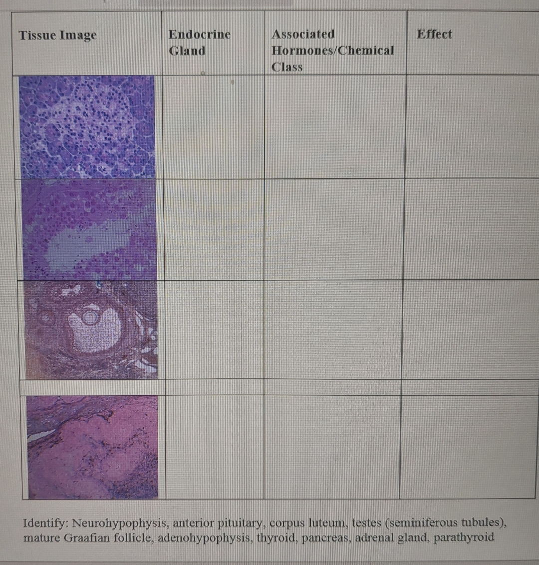 Solved \table[[Tissue Image,Endocrine Gland,Associated | Chegg.com
