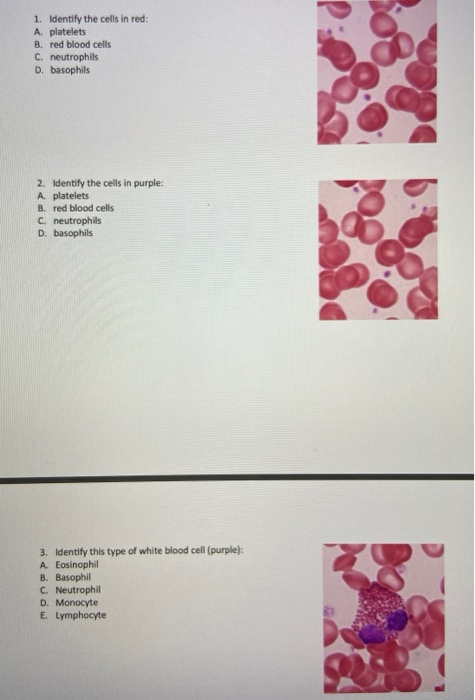 Solved 4. Identify this type of white blood cell (purple): A | Chegg.com