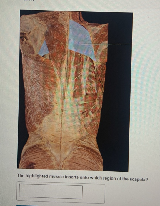 Solved The highlighted muscle inserts onto which region of | Chegg.com