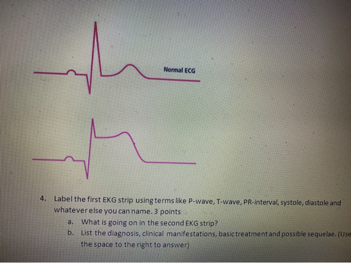 Solved Normal ECG 4. Label the first EKG strip using terms | Chegg.com