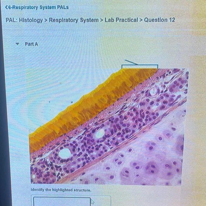 66-Respiratory System PALs PAL: Histology > | Chegg.com 66-Respiratory System PALs PAL: Histology > | Chegg.com