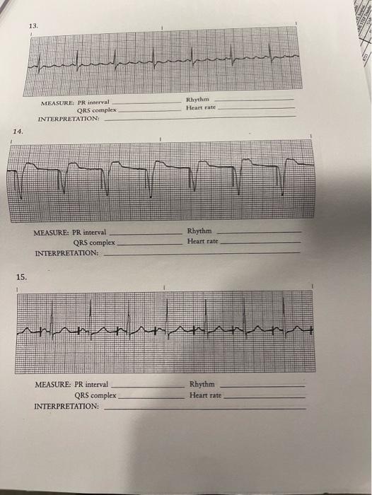 QRS complex INTERPRETATION: MEASURE: PR interval | Chegg.com
