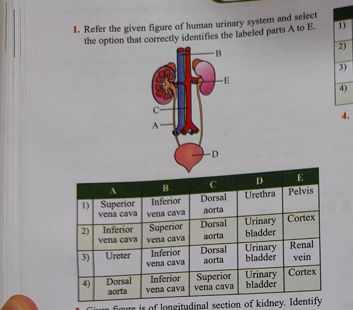 Solved Refer the given figure of human urinary system and | Chegg.com