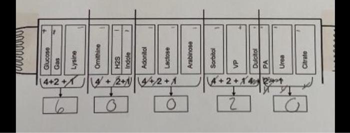 Solved Entero Pluri Test 8 pts Discuss and interpret your | Chegg.com
