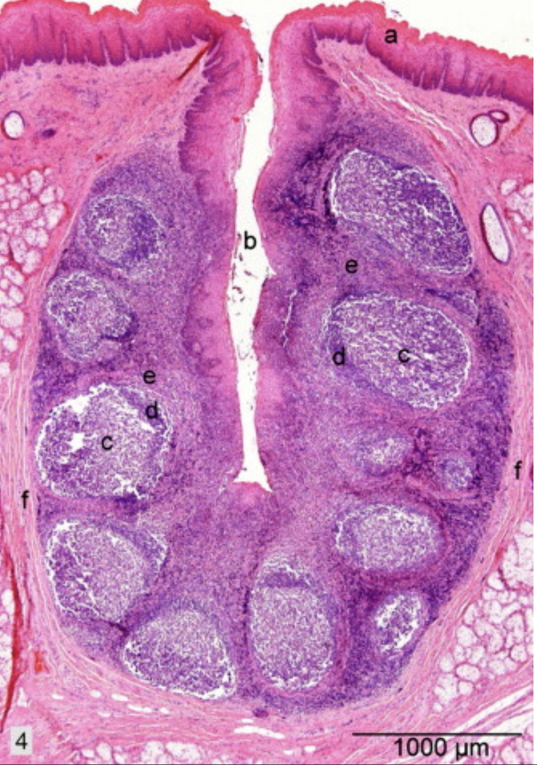 Solved microscopic view of a lingual tonsil. Name all A-F | Chegg.com