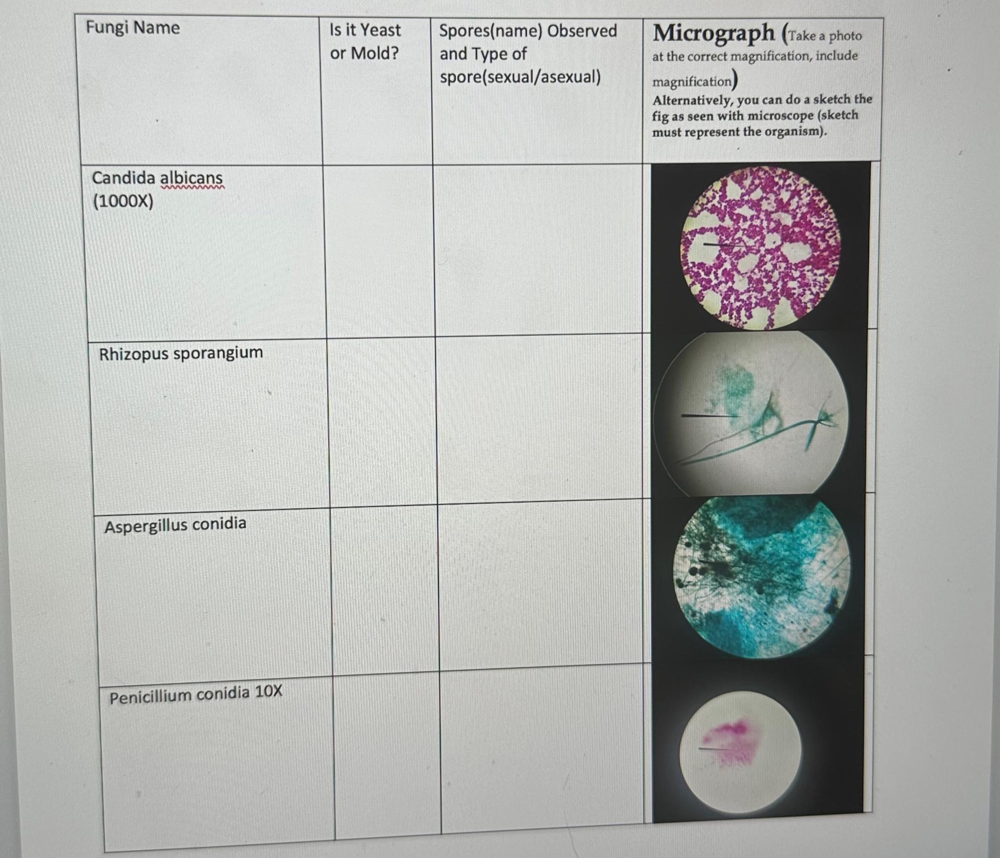 Solved Fungi NameIs it Yeast or Mold?Spores(name) ﻿Observed | Chegg.com