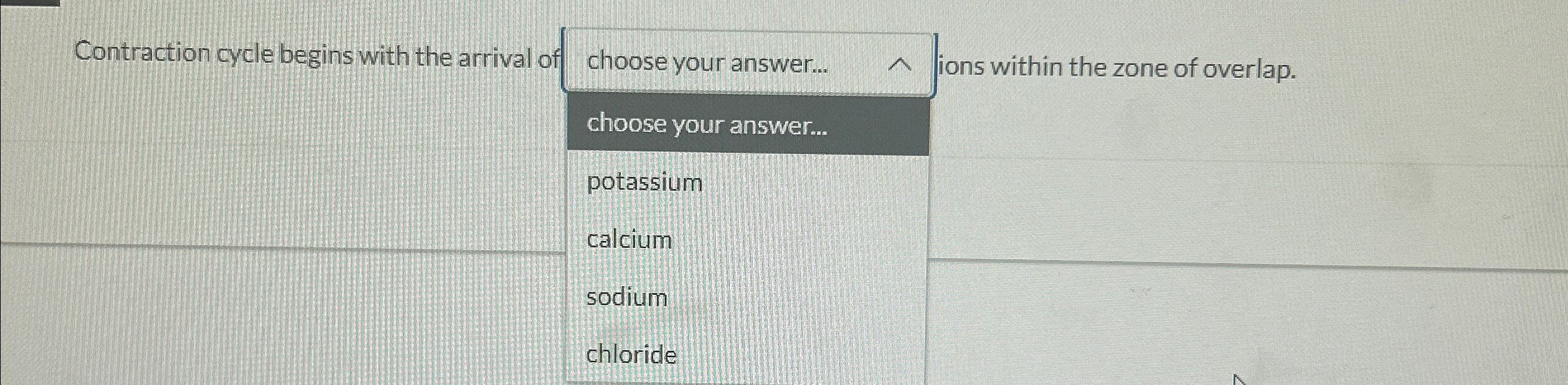 Solved Contraction cycle begins with the arrival of choose | Chegg.com